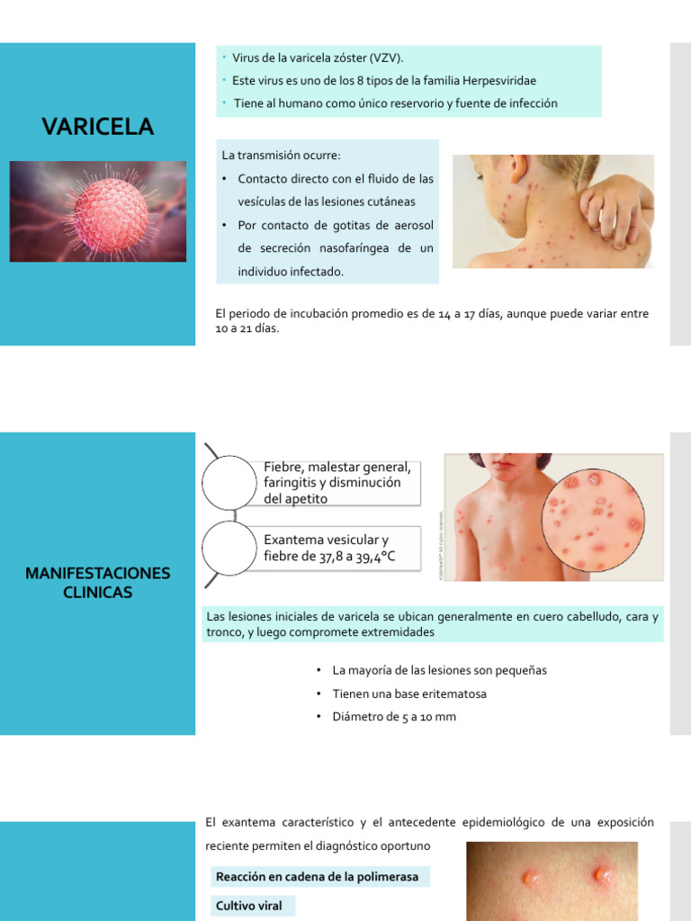Varicela: Diagnóstico y Tratamiento | PDF | Ciencias de la Salud ...