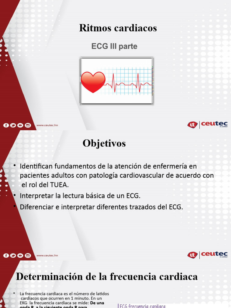 Presentación 9. AAAM ECG III parte Q3-2021 | PDF | Electrocardiografia ...