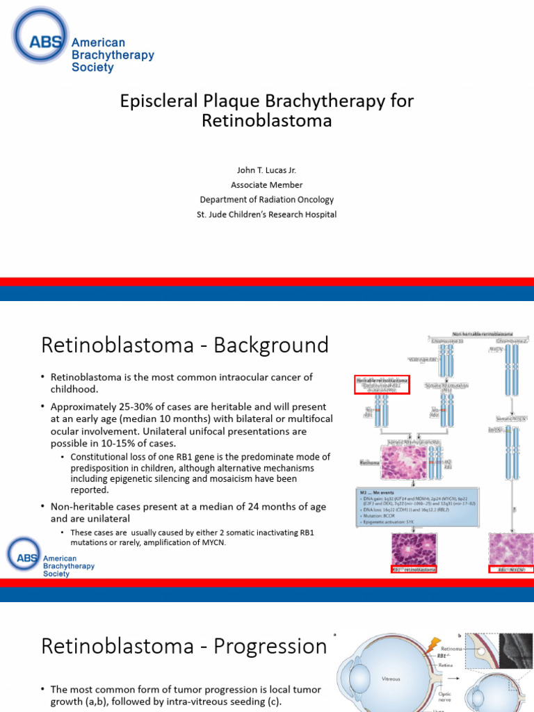 Episcleral Plaque Brachytherapy for Retinoblastoma | PDF | Radiation ...