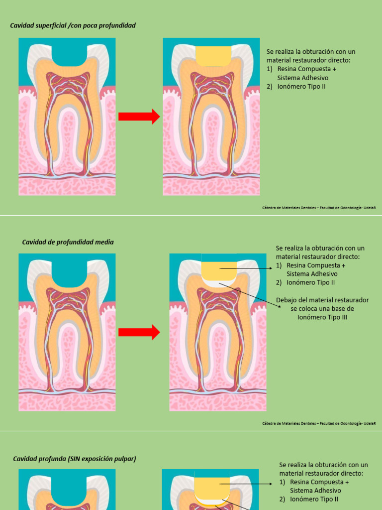 Protectores Pulpares Esquema | PDF | Odontología | Medicina
