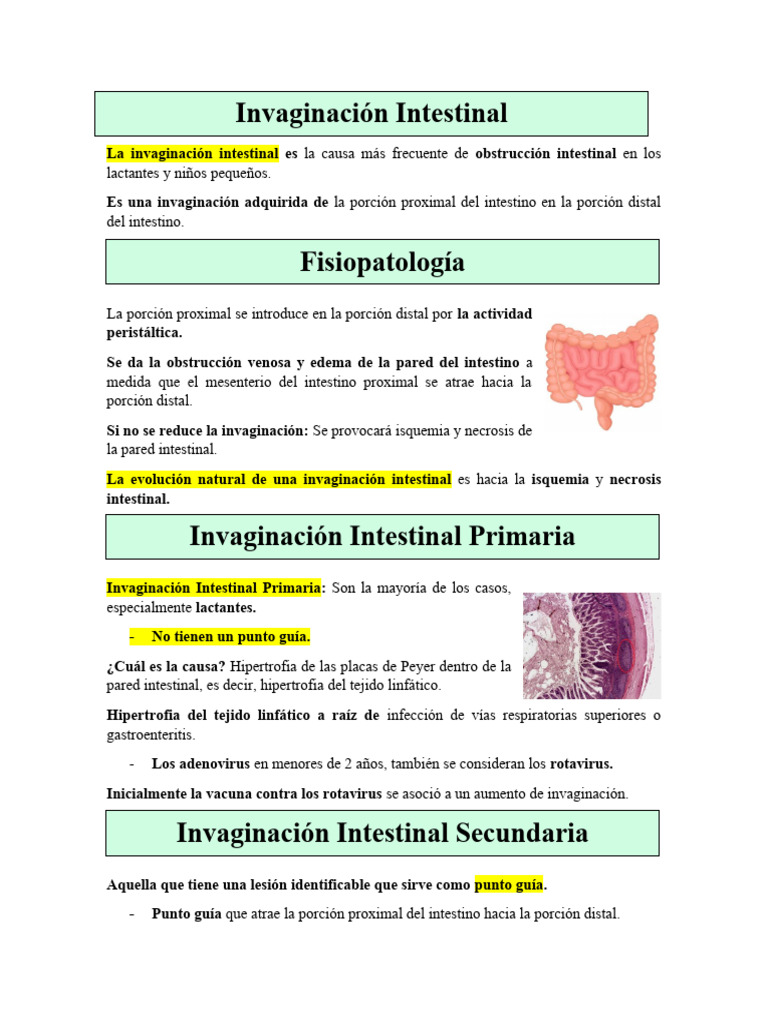 Invaginación Intestinal | PDF | Tracto gastrointestinal | Ct Scan