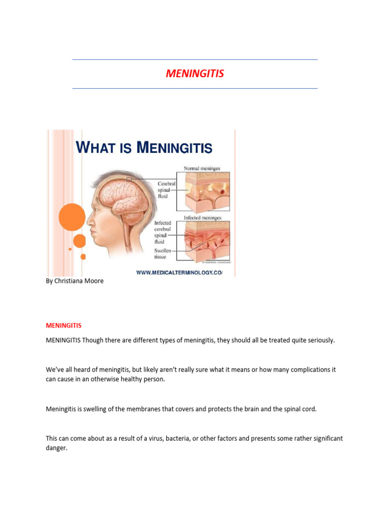 Meningitis | Download Free PDF | Meningitis | Immunology