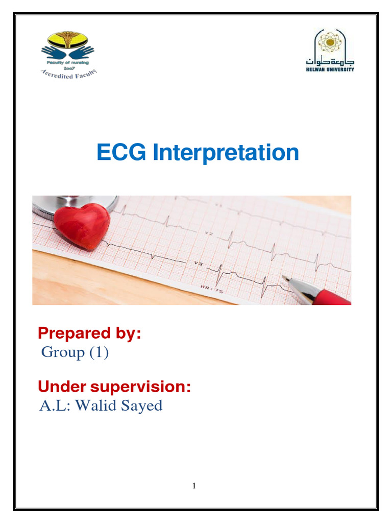 ECG Interpretation: Prepared by | PDF | Electrocardiography | Heart Valve