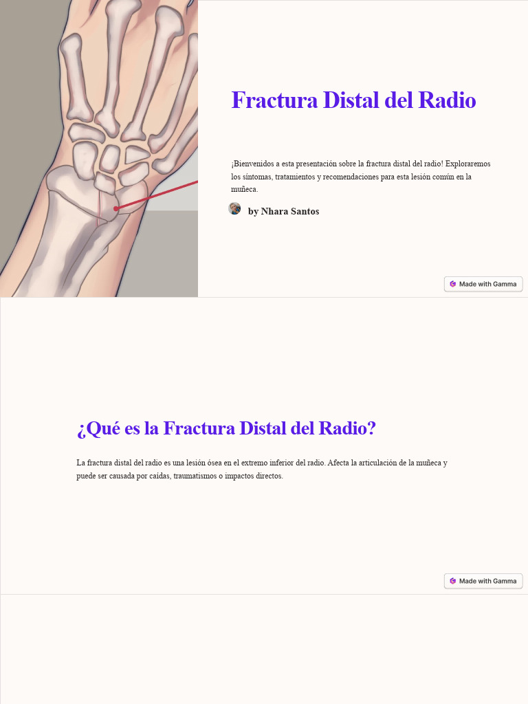 Fractura Distal Del Radio | PDF