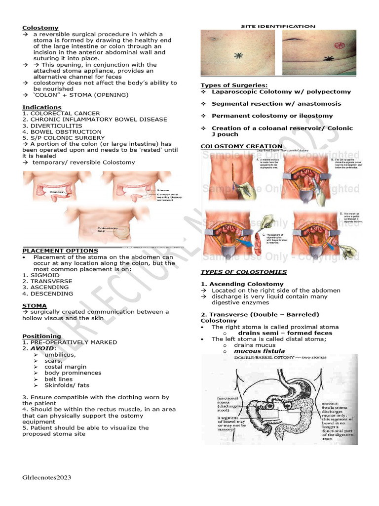 Colostomy Guide for Healthcare Pros | PDF | Medical Specialties ...