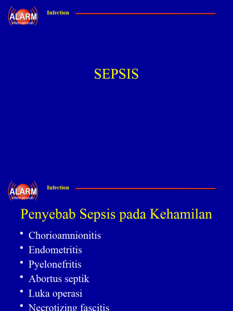 Sepsis Management and Pathogenesis Overview | PDF | Sepsis | Causes Of ...