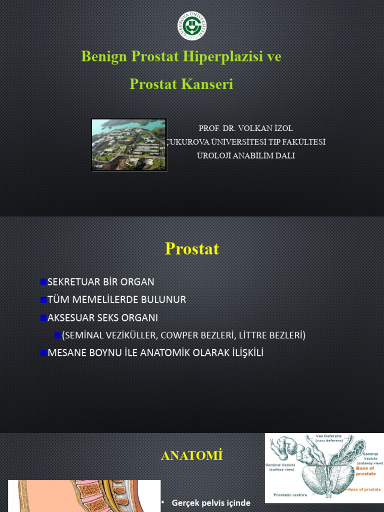 Prostat Hastalıkları | PDF