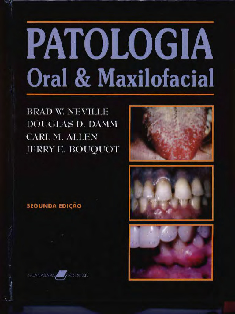 Patologia Oral e Maxilofacial - Neville | PDF