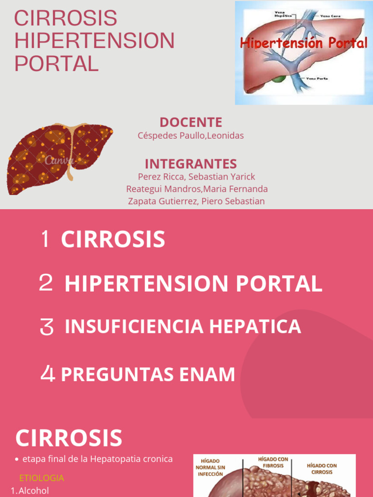 Cirrosis, Hipertension Portal | PDF | Cirrosis | Especialidades Medicas
