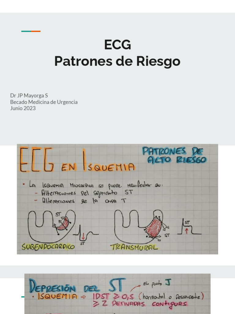 ECG Patrones de Riesgo | PDF | Infarto de miocardio | Electrocardiografia