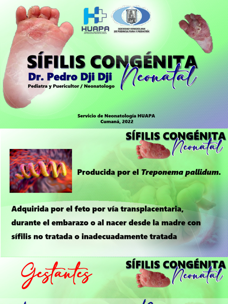 Manejo de Sífilis Congénita Neonatal | PDF | Infantes | El embarazo