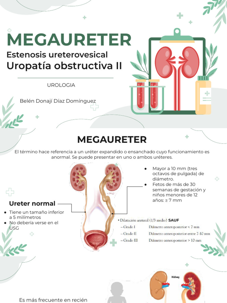 Megaureter: Diagnóstico y Tratamiento | PDF | Especialidades Medicas ...