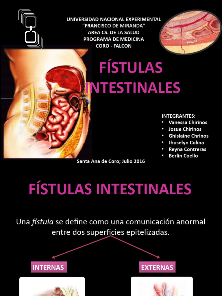 Manejo de Fístulas Intestinales y Parche de Wittmann | PDF | Septicemia ...