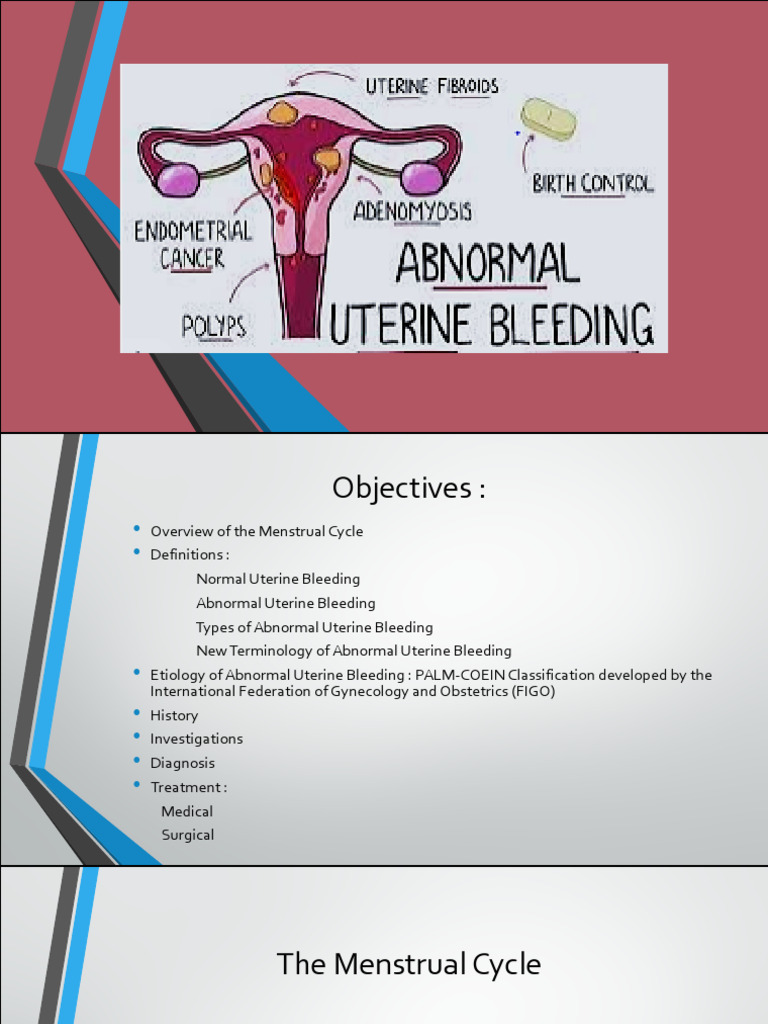 Abnormal Uterine Bleeding Final | PDF | Menstrual Cycle | Ovary
