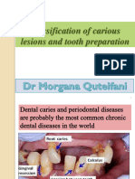 G.V. Blacks Classification of Caries | PDF | Animal Anatomy | Health ...