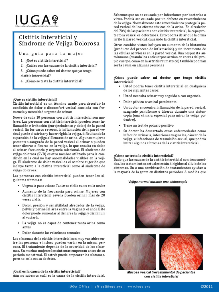 Interstitial Cystitis Spanish | PDF | Infección del tracto urinario ...