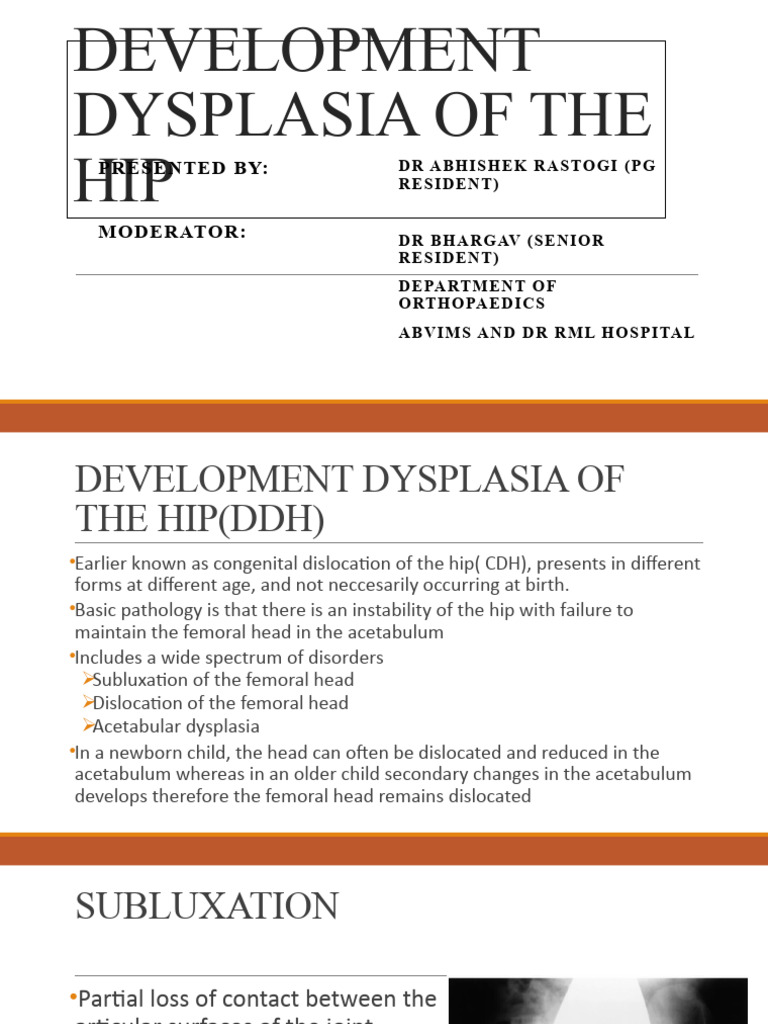 Development Dysplasia of The Hip-2 | PDF | Hip | Anatomical Terms Of Motion