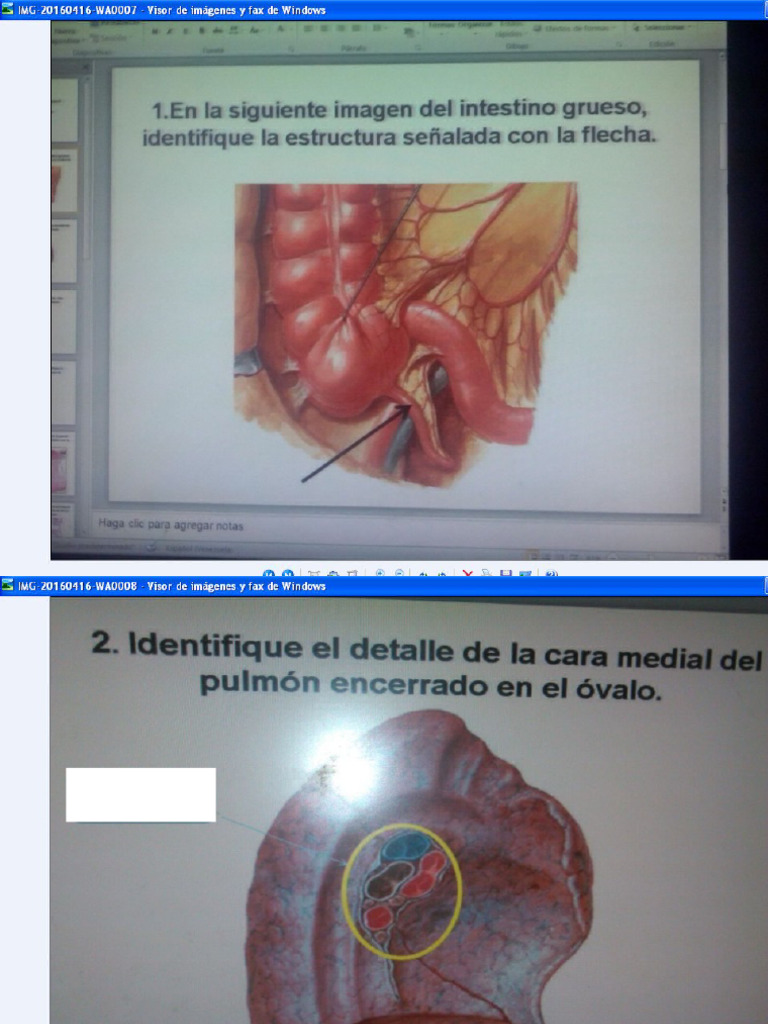 morfo IV modelo 6-1 | PDF | Anatomía | Órgano (anatomía)