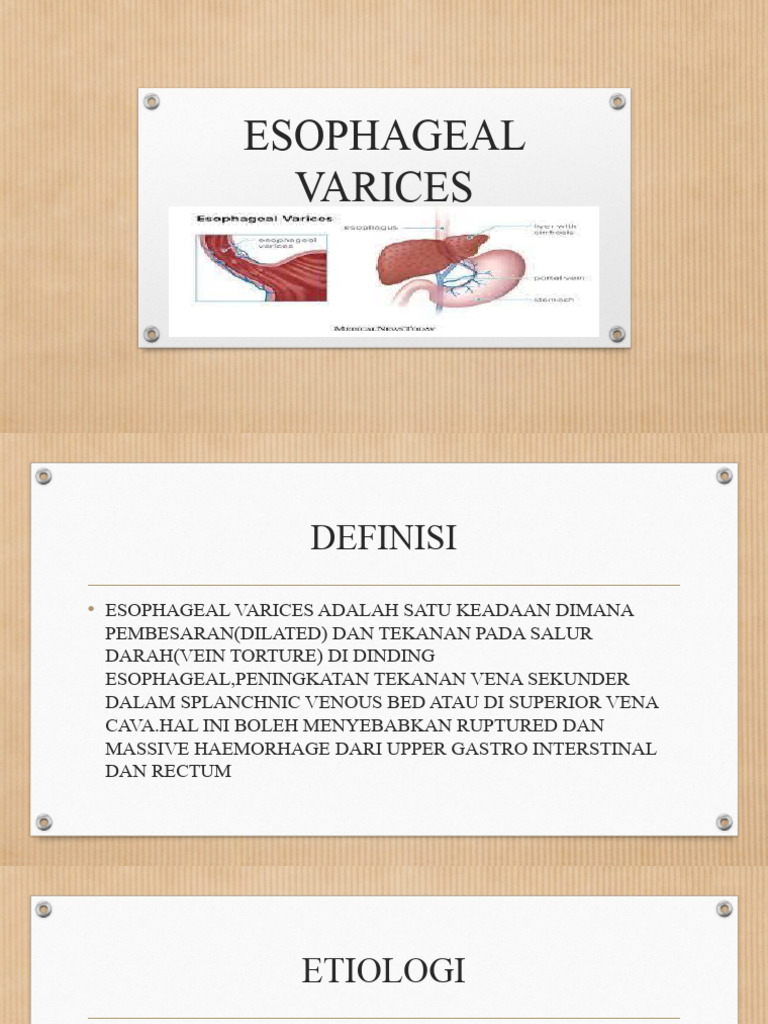 Esophageal Varices | PDF