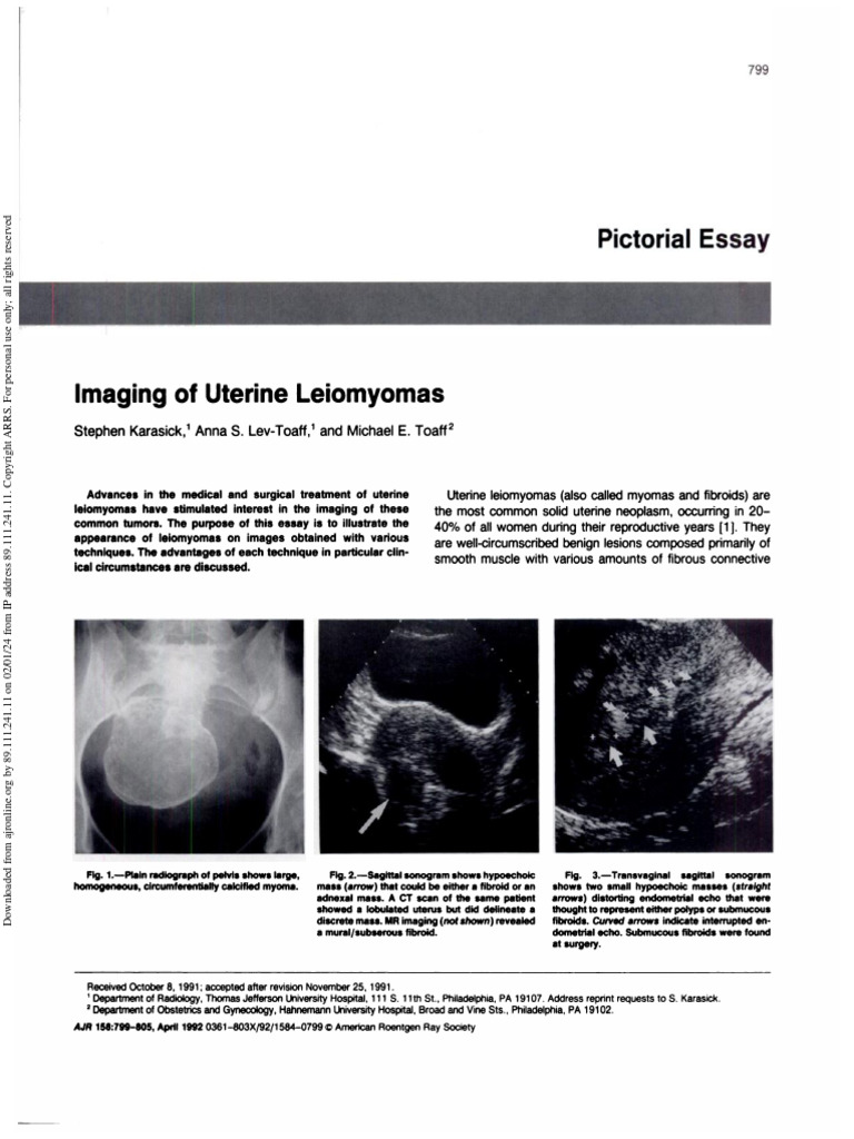 Karasick Et Al 2013 Imaging of Uterine Leiomyomas | PDF | Uterus ...