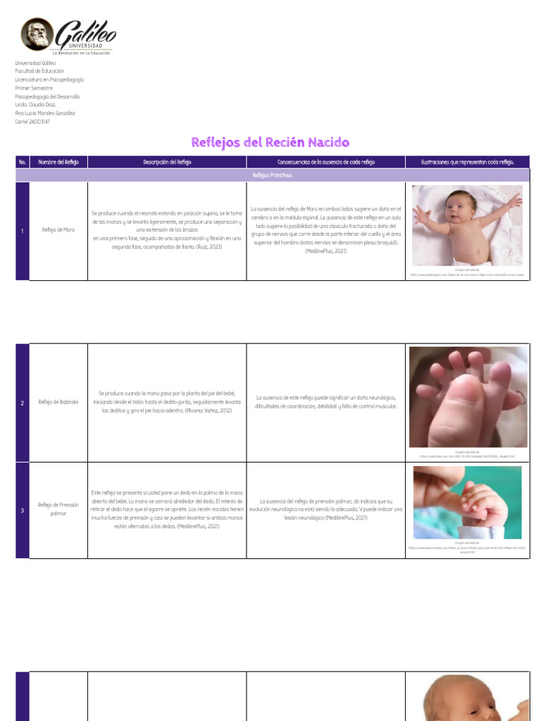 Reflejos_del_Reci_n_Nacido | PDF