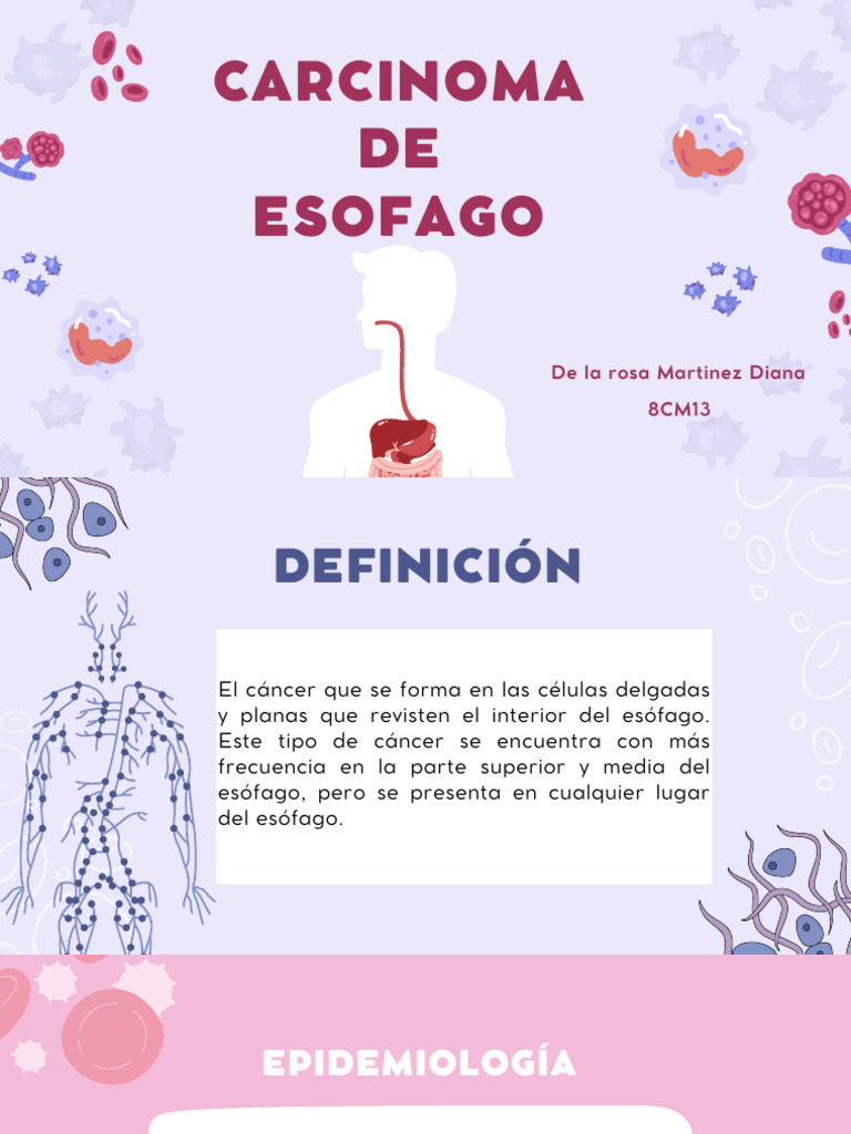 Carcinoma de Esofago | PDF