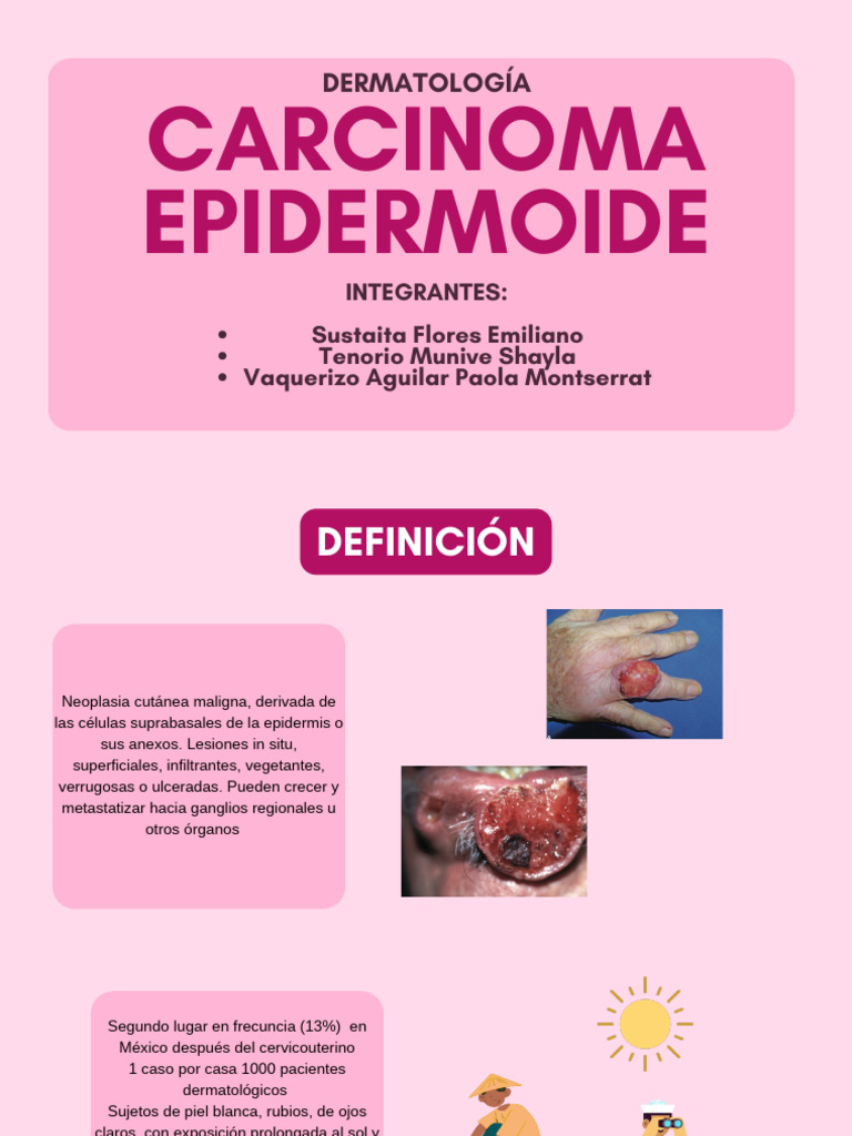Carcinoma Epidermoide: Definición y Tratamiento | PDF | Metástasis | Piel