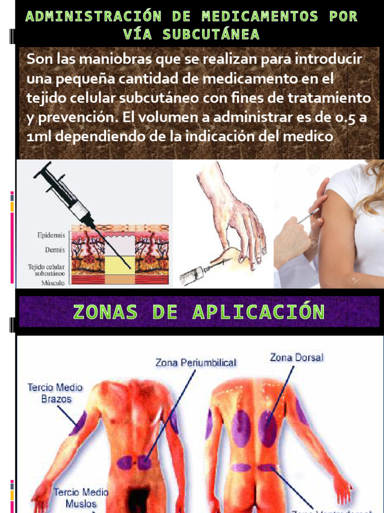 Administracion de Medicamentos Por Via Subcutanea | PDF | Inyección ...