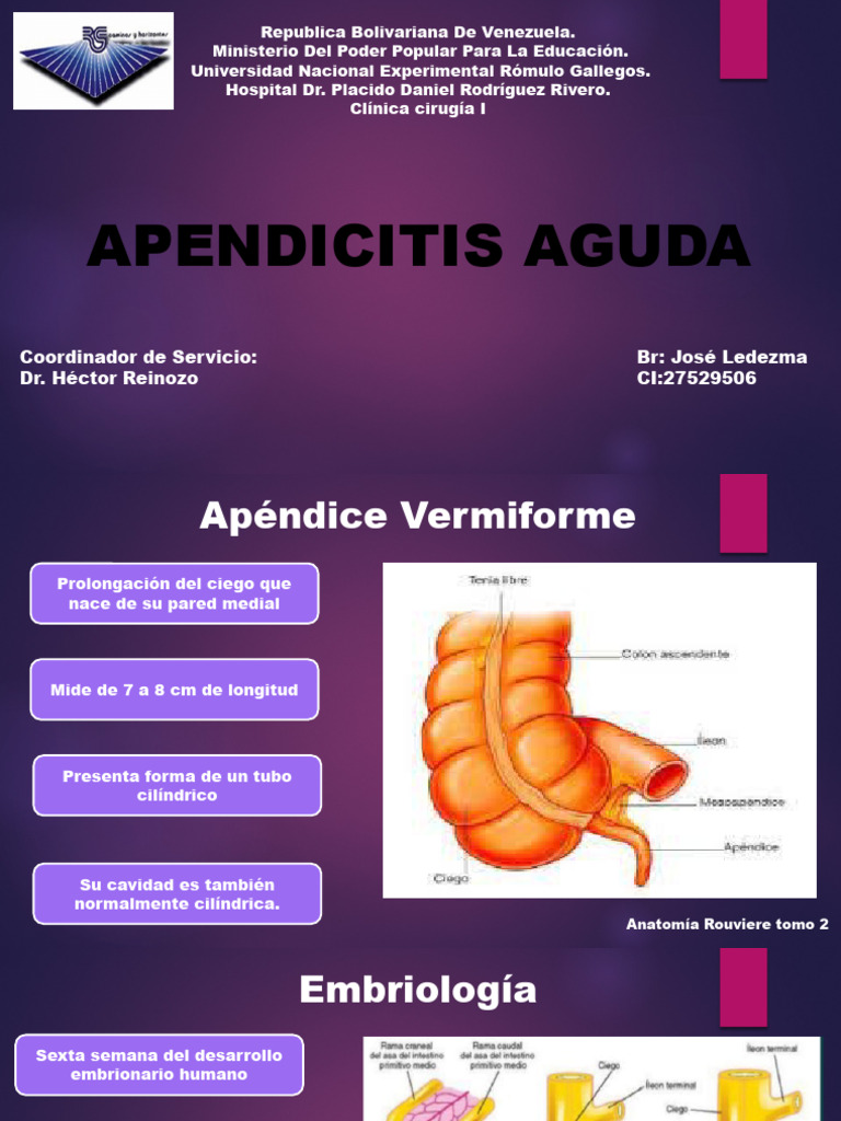 Apendicitis Aguda | PDF | Especialidades Medicas | Medicina CLINICA