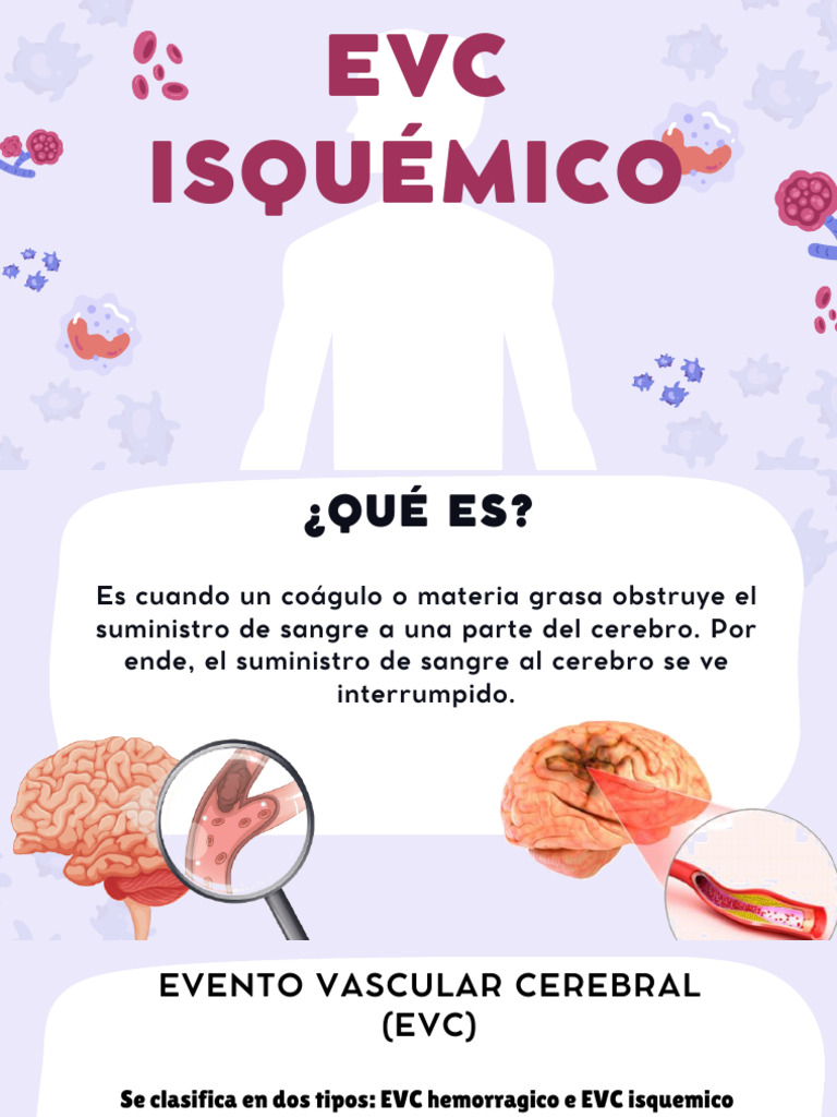 Evc Isquemico | PDF