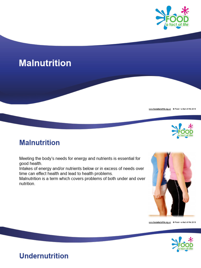 malnutrition-ppt-1416he | PDF | Malnutrition | Nutrition