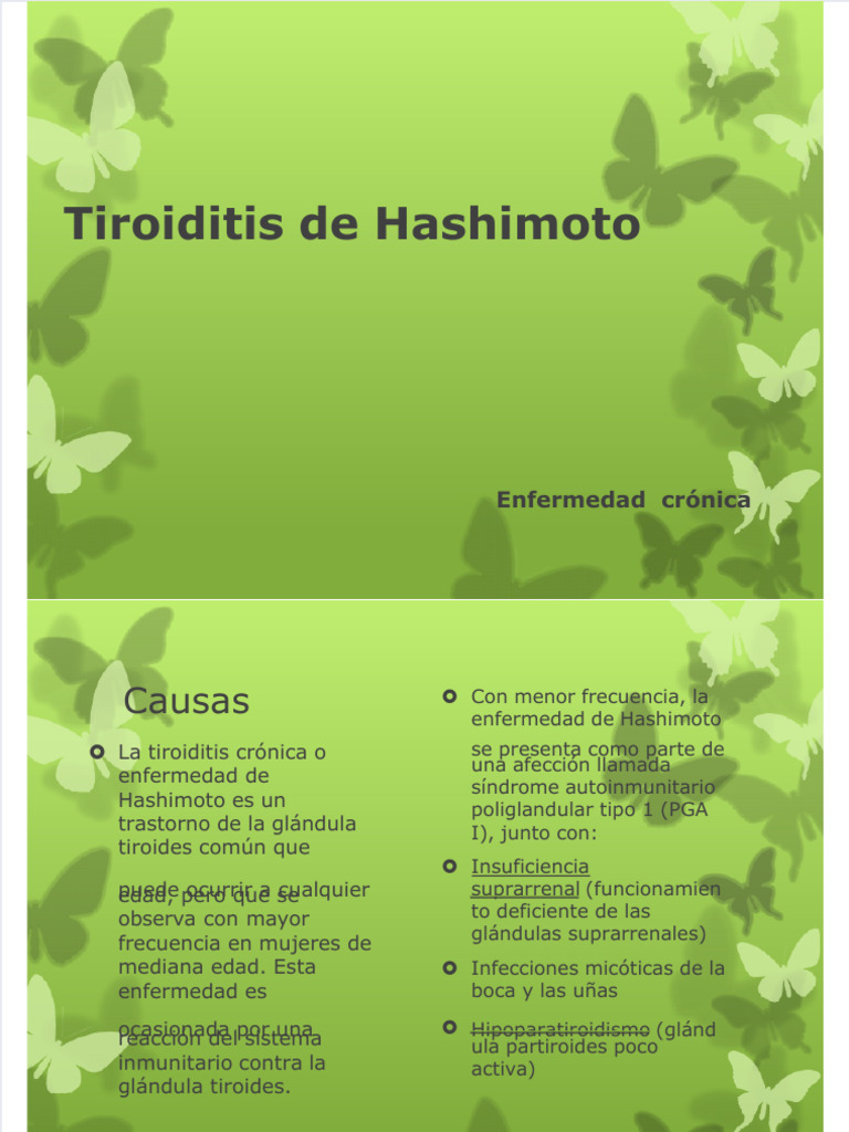 Tiroiditis de Hashimotopptx | Descargar gratis PDF | Tiroides ...