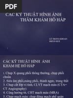 Các dấu hiệu X quang ngực | PDF