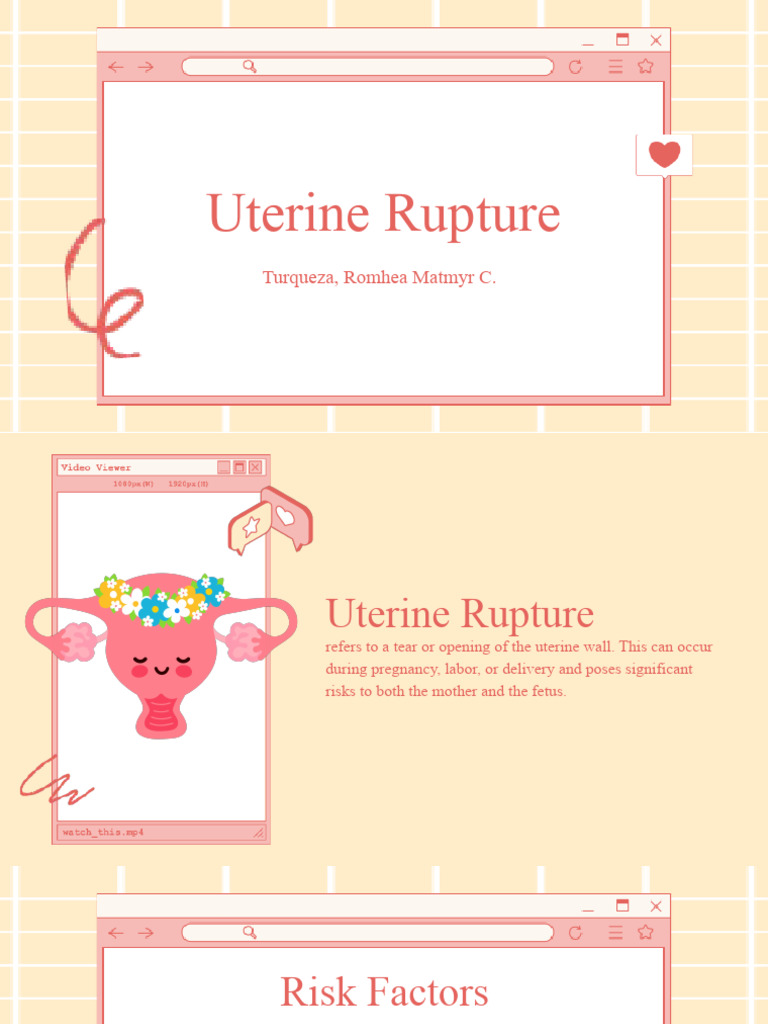 Uterine Rupture Risks & Signs | PDF | Science & Mathematics