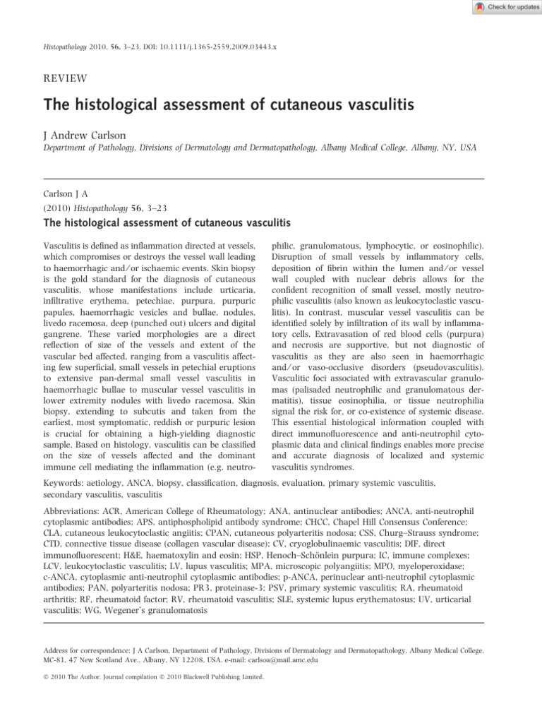 Histopathology - 2009 - Carlson - The histological assessment of cutaneous vasculitis (1) | PDF ...