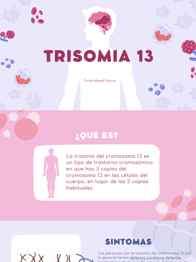 Presentación trisomia 13 | PDF | Enfermedades y trastornos | Especialidades Medicas
