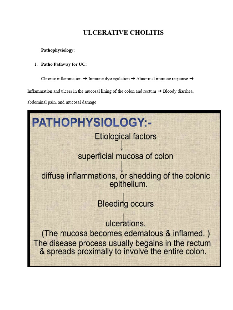 Uclerative colitis | PDF | Ulcerative Colitis | Clinical Medicine