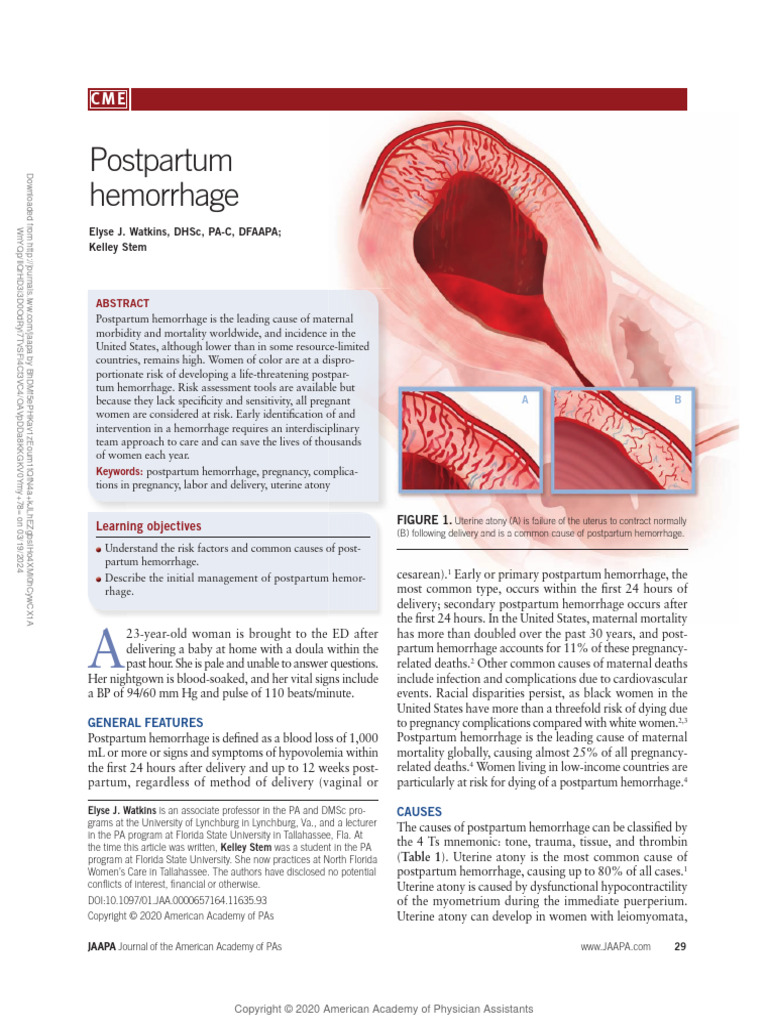 Postpartum Hemorrhage.4 | Download Free PDF | Childbirth | Diseases And ...