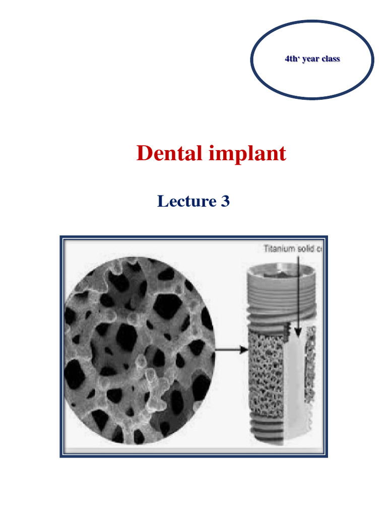 DENTAL Implant | PDF | Dental Implant | Bone