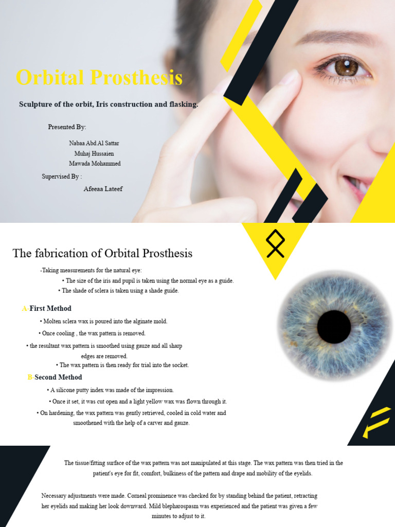 Orbital Prosthesis | PDF | Poly(Methyl Methacrylate) | Paint