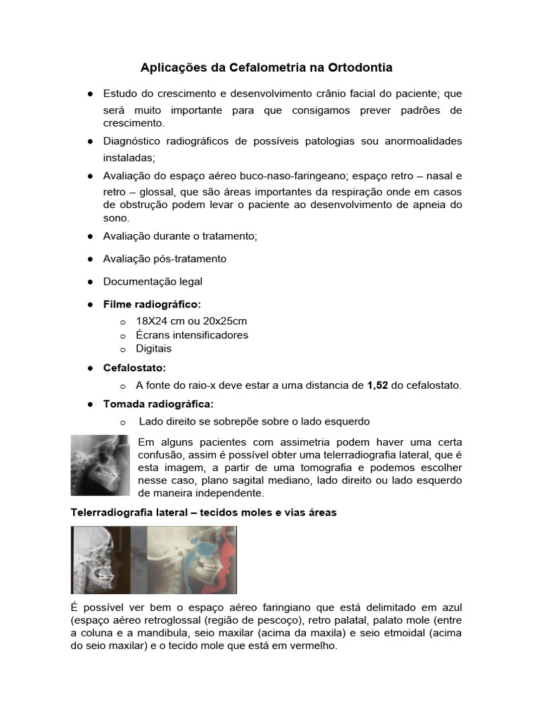 Cefalometria na Ortodontia: Aplicações e Análise | PDF | Anatomia