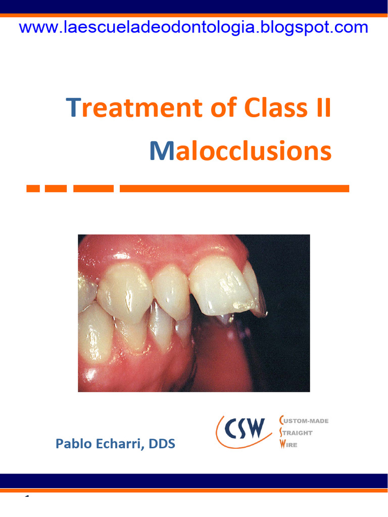 Treatment of Class II Malocclusions - Pablo Echarri | PDF | Mouth ...