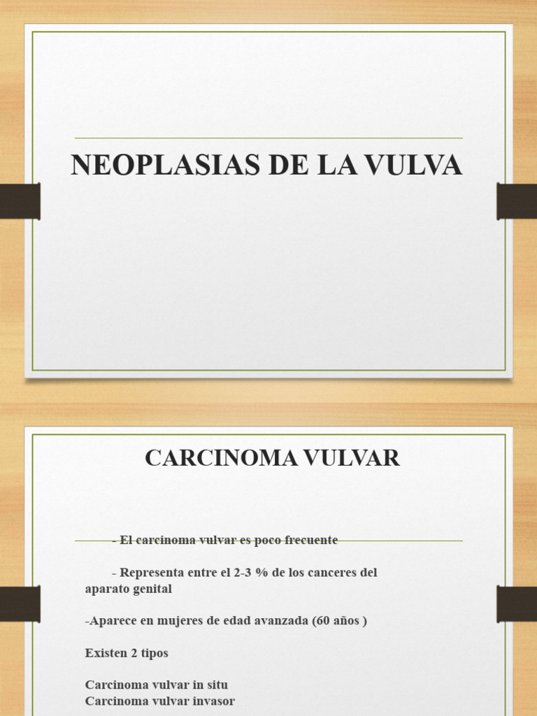 Carcinoma Vulvar | PDF | Ciencia y matemáticas