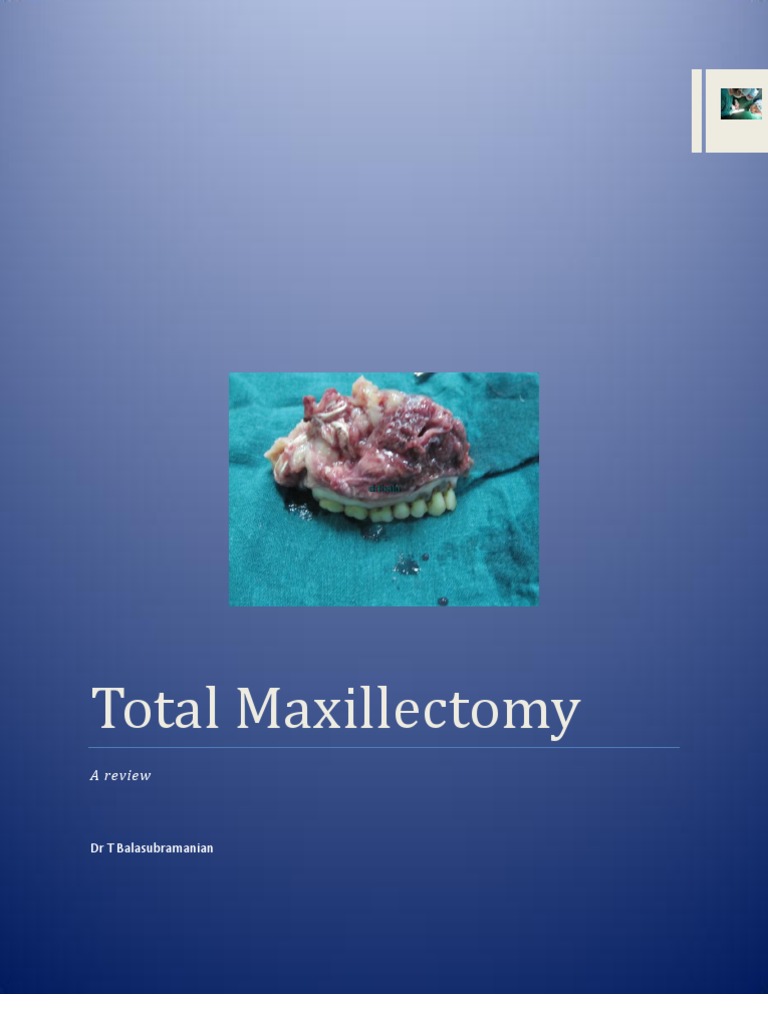 Total Maxillectomy: Techniques and Indications | PDF | Surgery | Human Nose