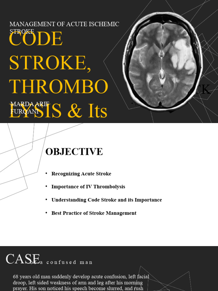 Management of Acute Stroke | PDF | Stroke | Blood Pressure