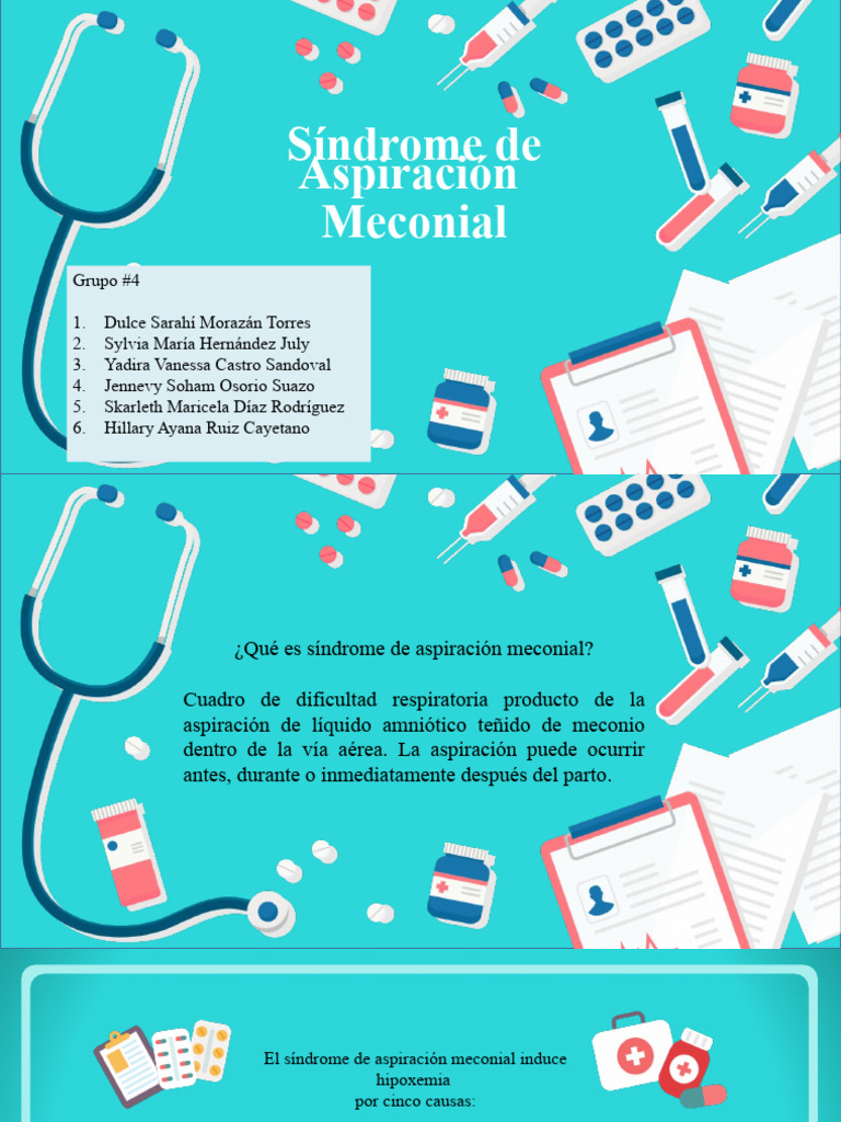 Síndrome de Aspiración Meconial: Diagnóstico y Manejo | PDF | Pulmón ...