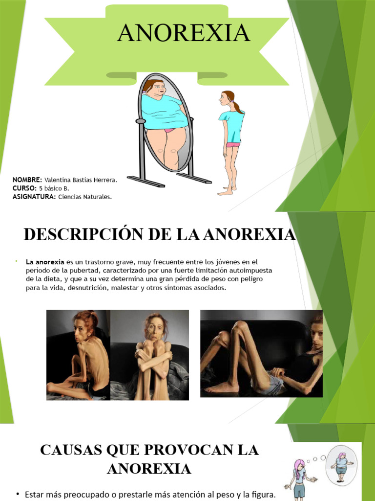 Causas y Consecuencias de la Anorexia | PDF | Anorexia nerviosa | Alimentos