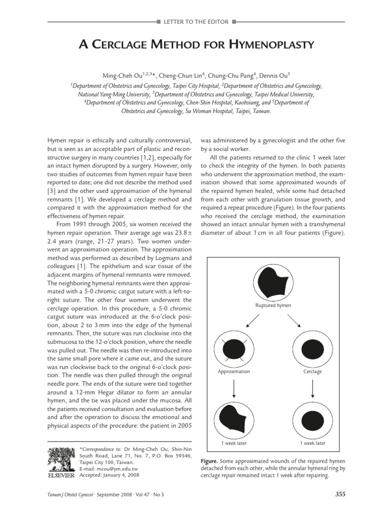 A_Cerclage_Method_for_Hymenoplasty | PDF | Gynaecology | Surgical Suture