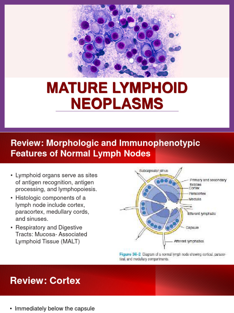 Week 15-Mature-Lymphoid-Neoplasms-SC | PDF | Lymph Node | Lymphatic System