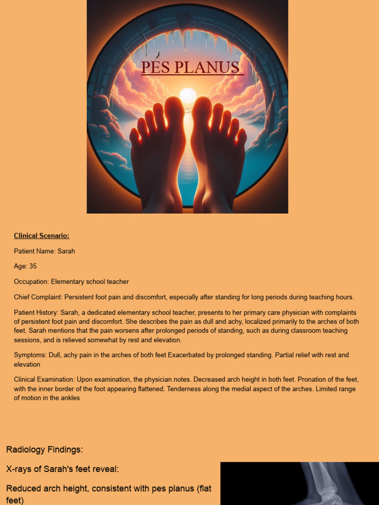 Pes Planus - flat feet | PDF | Foot | Diseases And Disorders